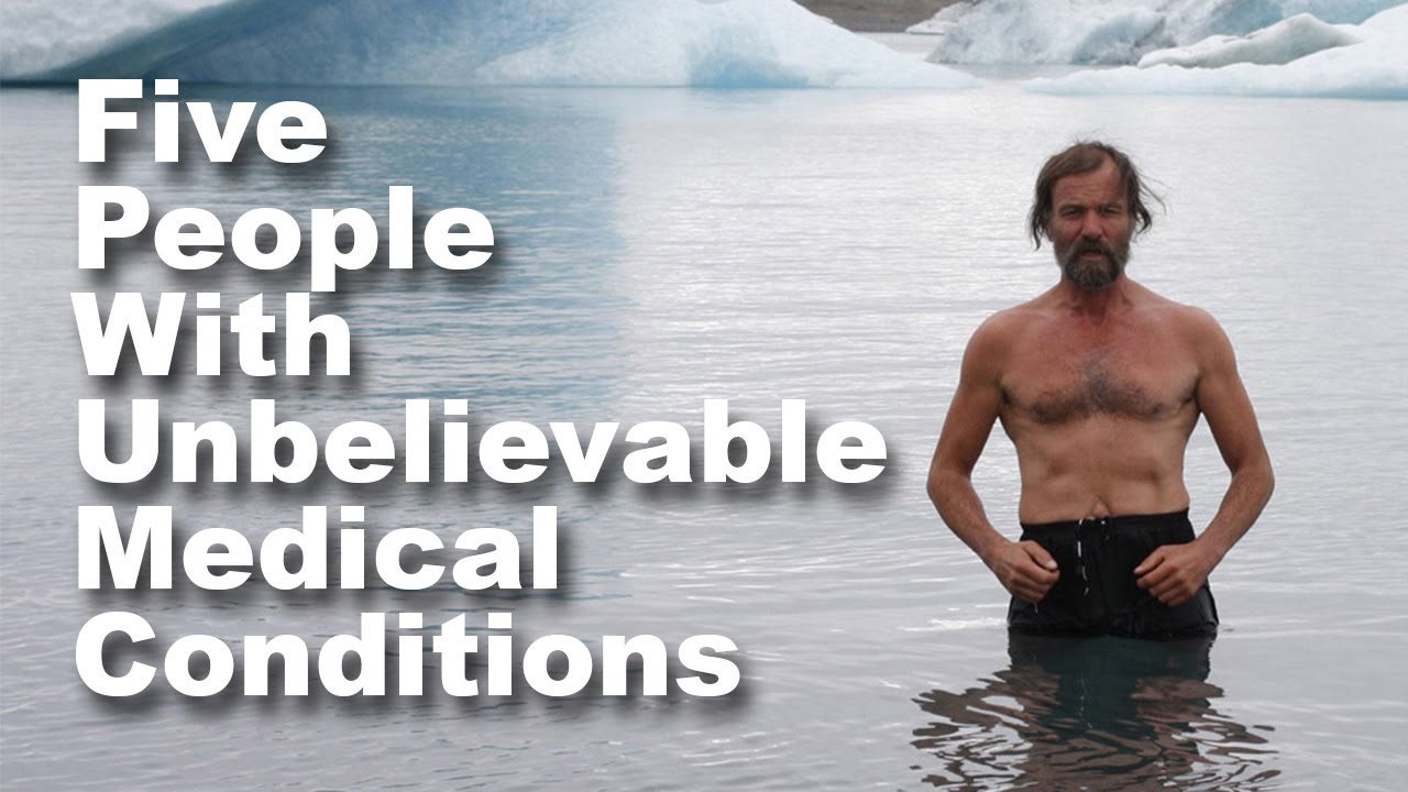 Five People with Unbelievable Medical Conditions - YouTube