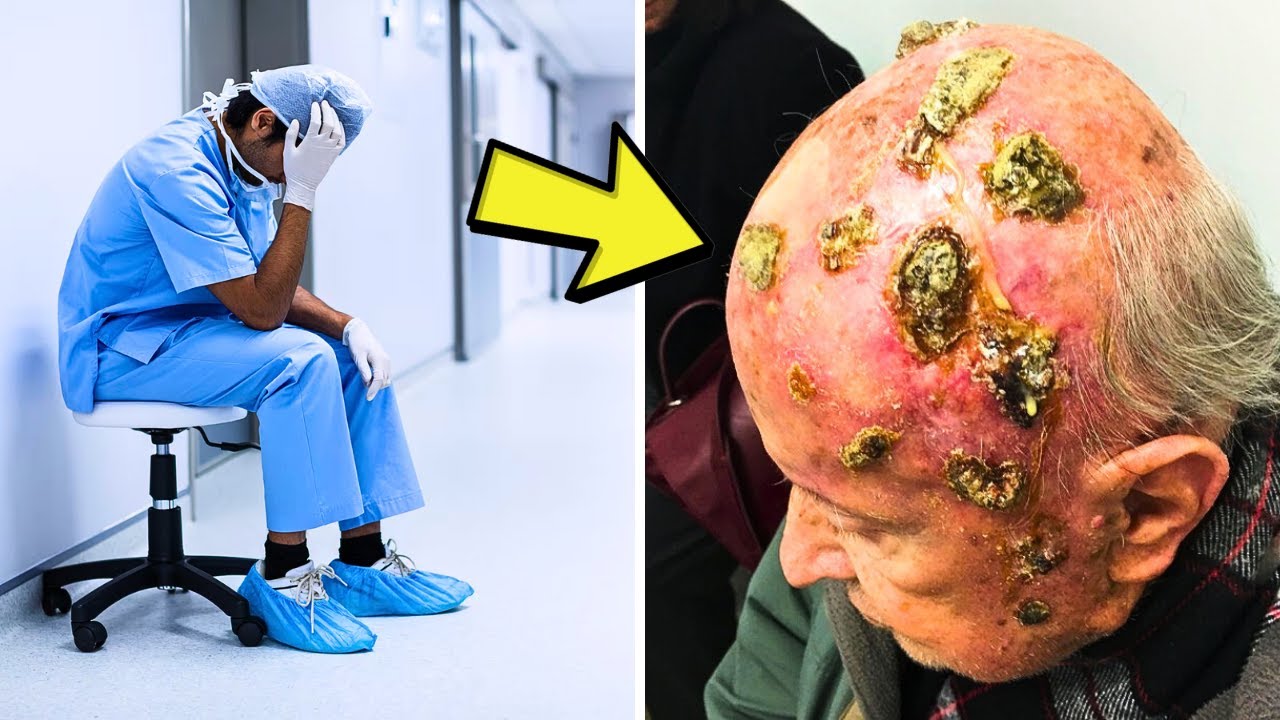 Fungus Ate His Face Alive - What Doctors Found Inside Will Shock You ...
