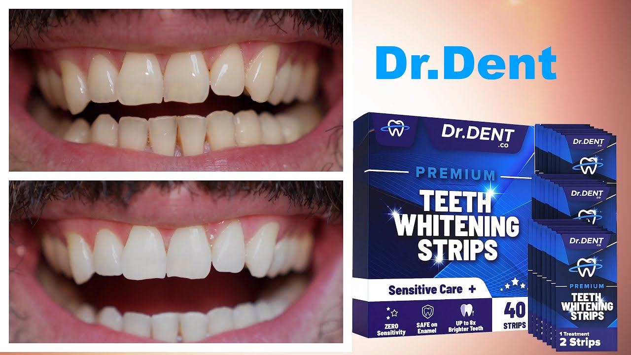 Dr Dent Teeth Whitening Strips 20 Days Review YouTube