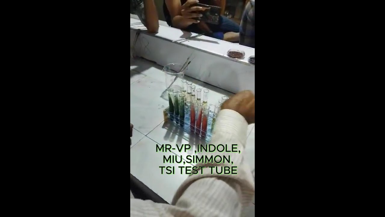 MR,VP, TSI, INDOLE TEST in Microbiology lab - YouTube
