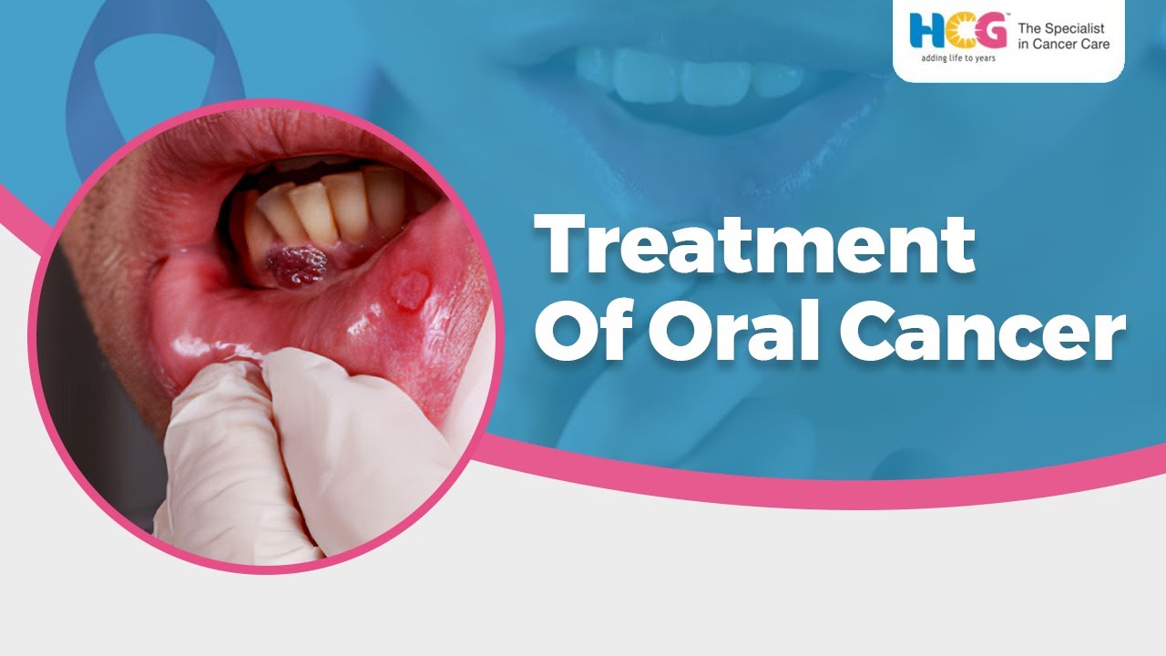 Treatment Of Oral Cancer | Robotic Surgery In Oral Cancer ...