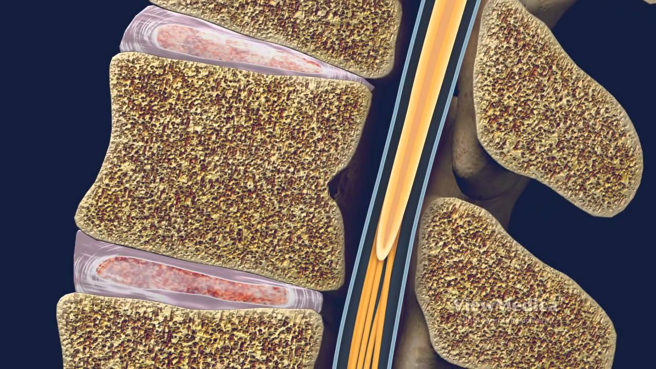 ViewMedica Demo Reel - YouTube