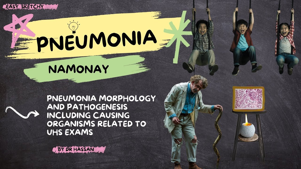 Pneumonia | Pathology | Respiratory System | Visual Mnemonic | Crack ...