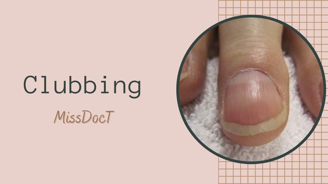 BASIC APPROACH TO CLUBBING - YouTube