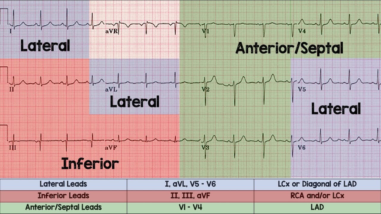 EKG in Buckets - YouTube