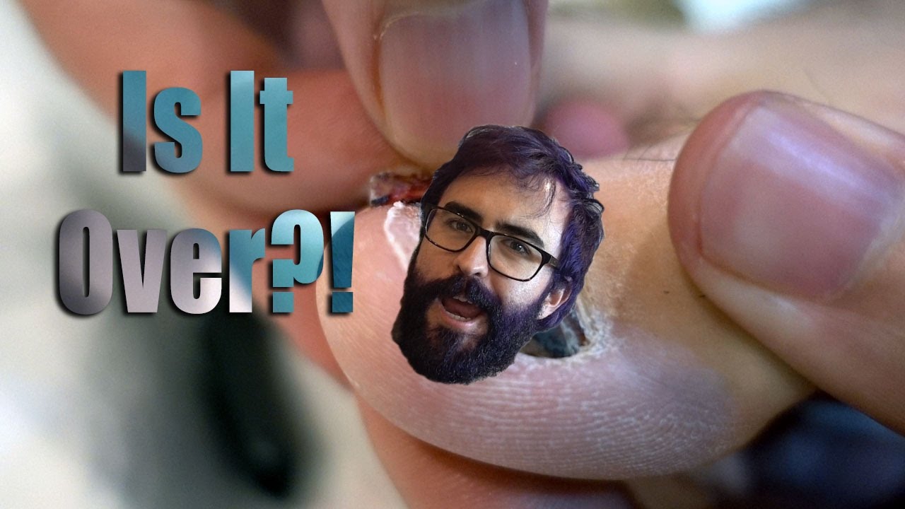 Ken's Gross Toe - The Final Chapter - YouTube