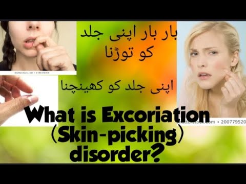 What is Excoriation disorder?||Skin-picking disorder||psychological ...
