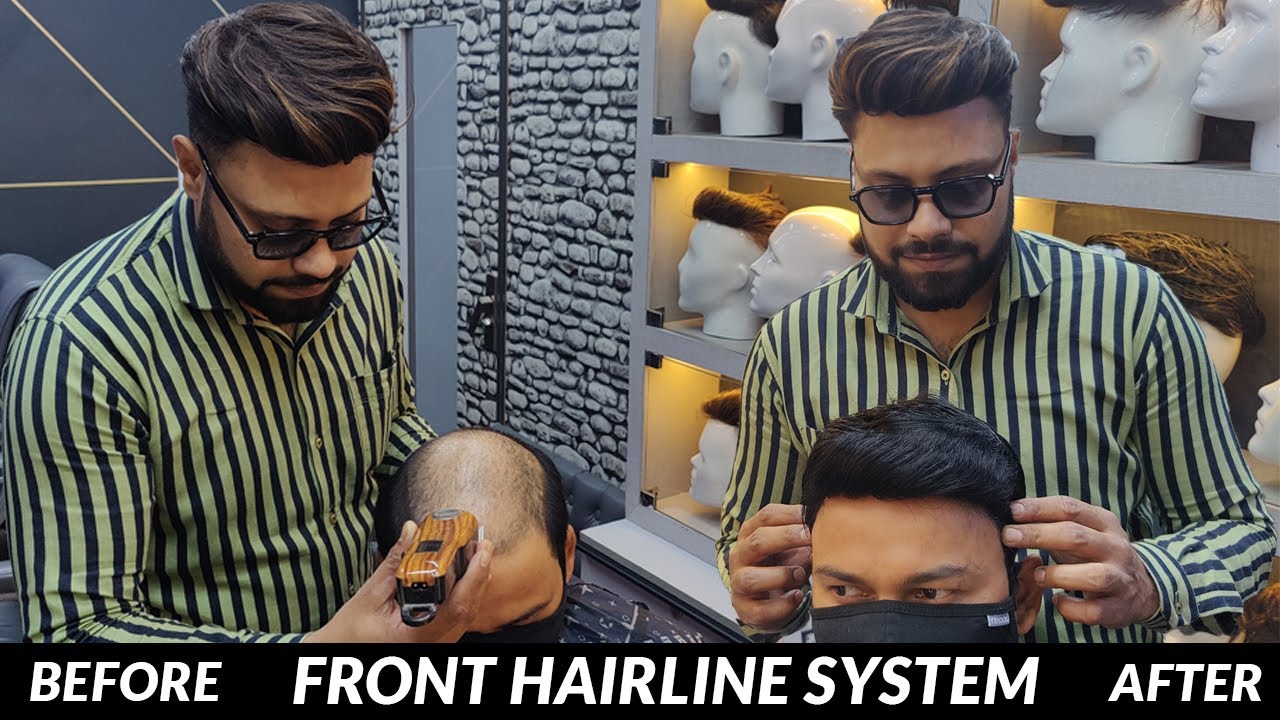 How To Make Your Front Hairline Hair Patches Look Natural | Front ...