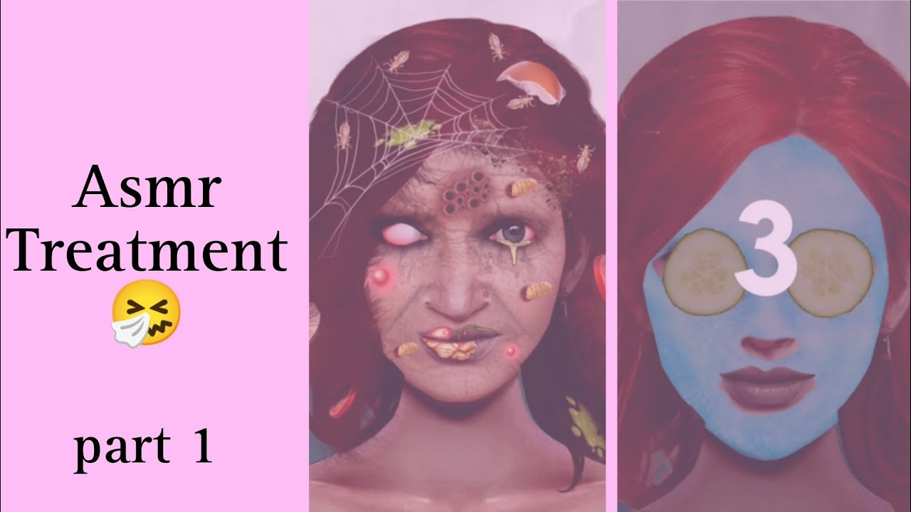 Asmr Treatment|| Part 1🤧 ||ASMR SBT 💕||Asmr Animation#asmr#makeup - YouTube