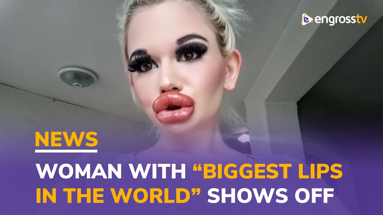 Woman with "Biggest Lips in the World" shows off huge new pout ...