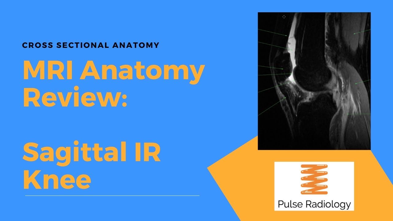 Sagittal Knee MRI Explained: Your Simple Patient-Friendly Guide ...
