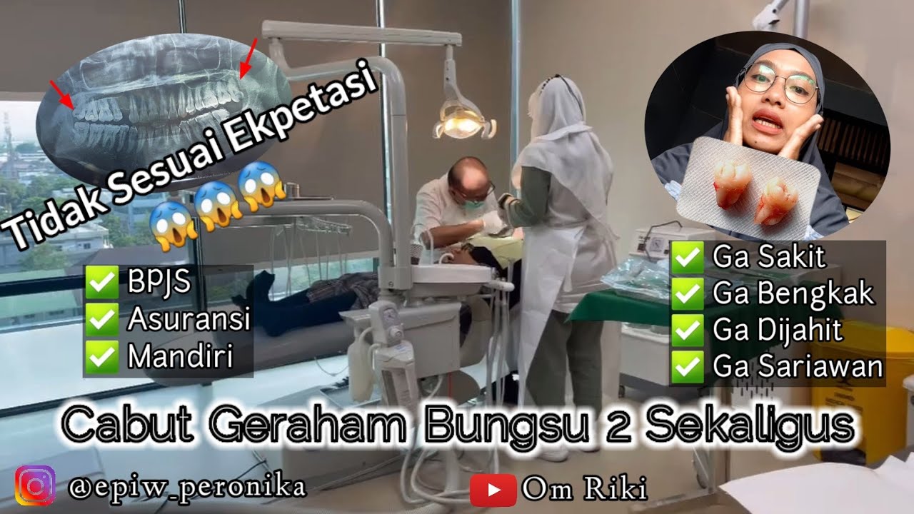 Pengalaman Cabut Gigi Geraham Bungsu Atas 2024 di Kota Medan | Wisdom ...