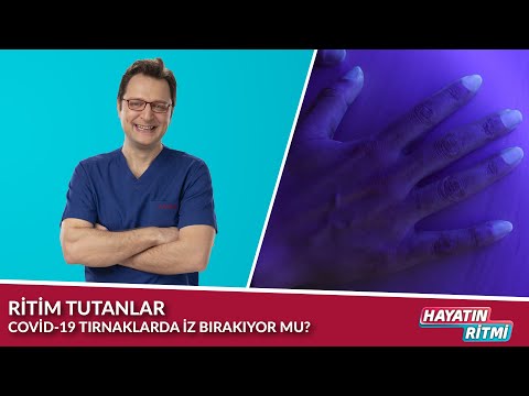 Ritim Tutanlar - Covid-19 tırnaklarda iz bırakıyor mu? UV Işık altında bu iz görünüyor mu?