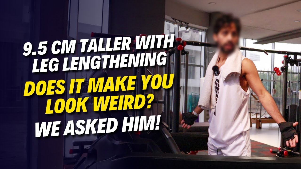 Does Limb Lengthening Make You Disproportionate? Real Patient Speaks ...