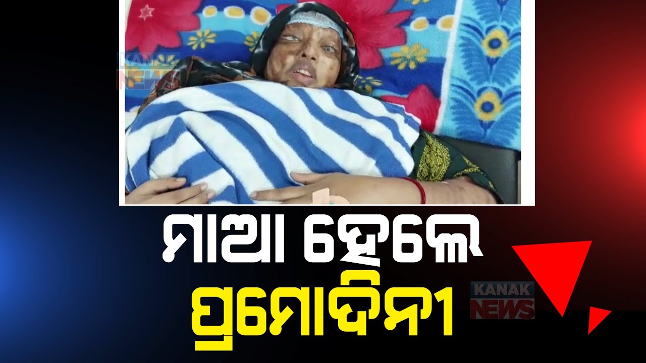 Odia Acid Attack Survivor Pramodini Roul Becomes Mother - YouTube
