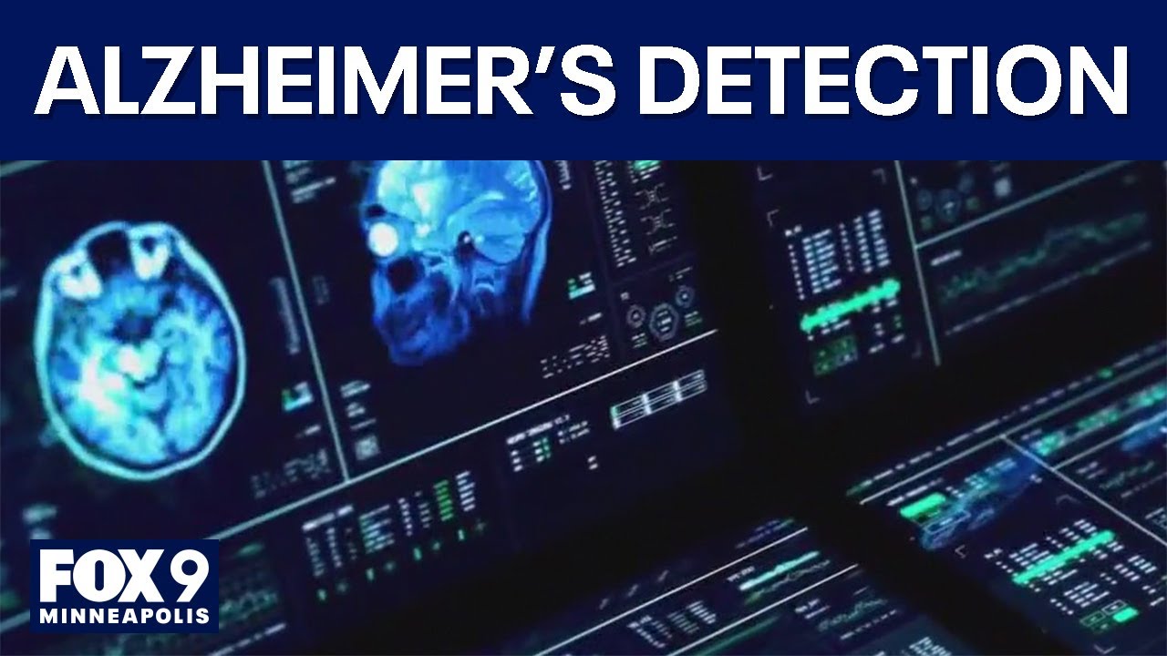 Alzheimer’s early detection proves pivotal as cases rise - YouTube