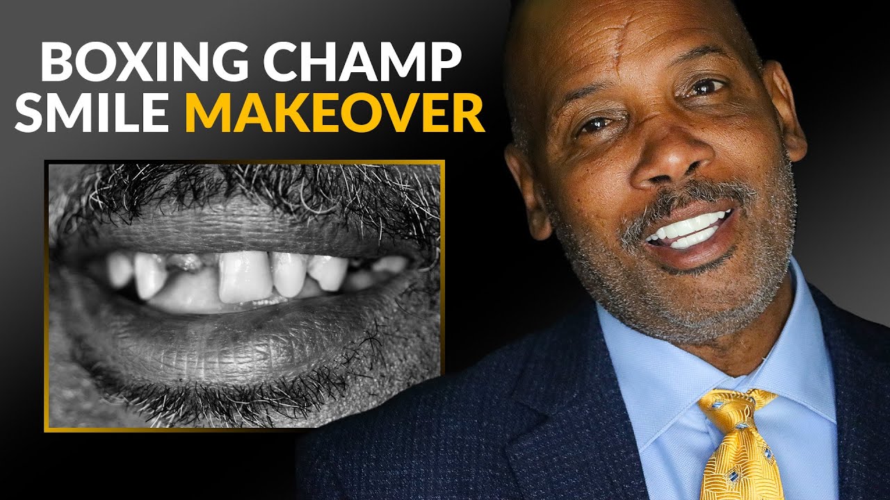 Before and After: From Missing Teeth To a Perfect Smile! He Upgraded ...