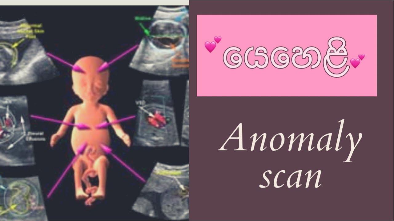 Anomalies Scan පරීක්ෂණය/Anomaly scan - YouTube