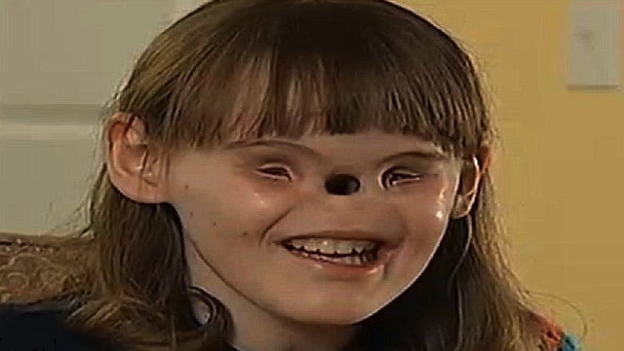 Curious Cases of Missing Body Parts - YouTube