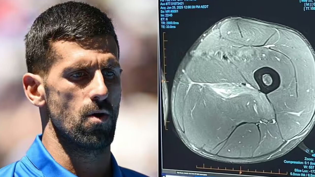 Novak Djokovic releases MRI scan blasting John McEnroe and other ...