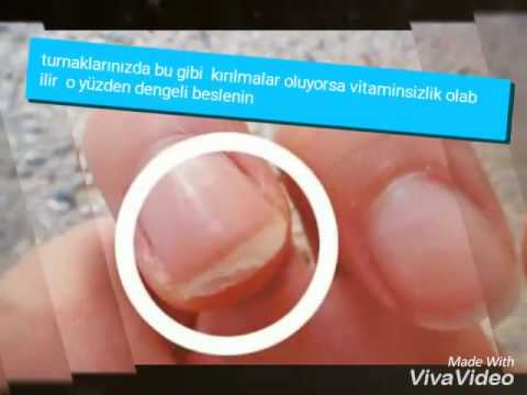 Hzlı tırnak uzatma yöntemleri