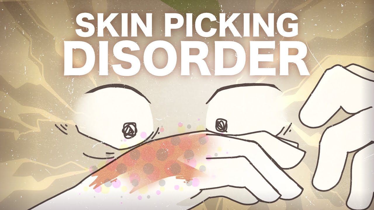 Skin Picking Disorder. What is it?
