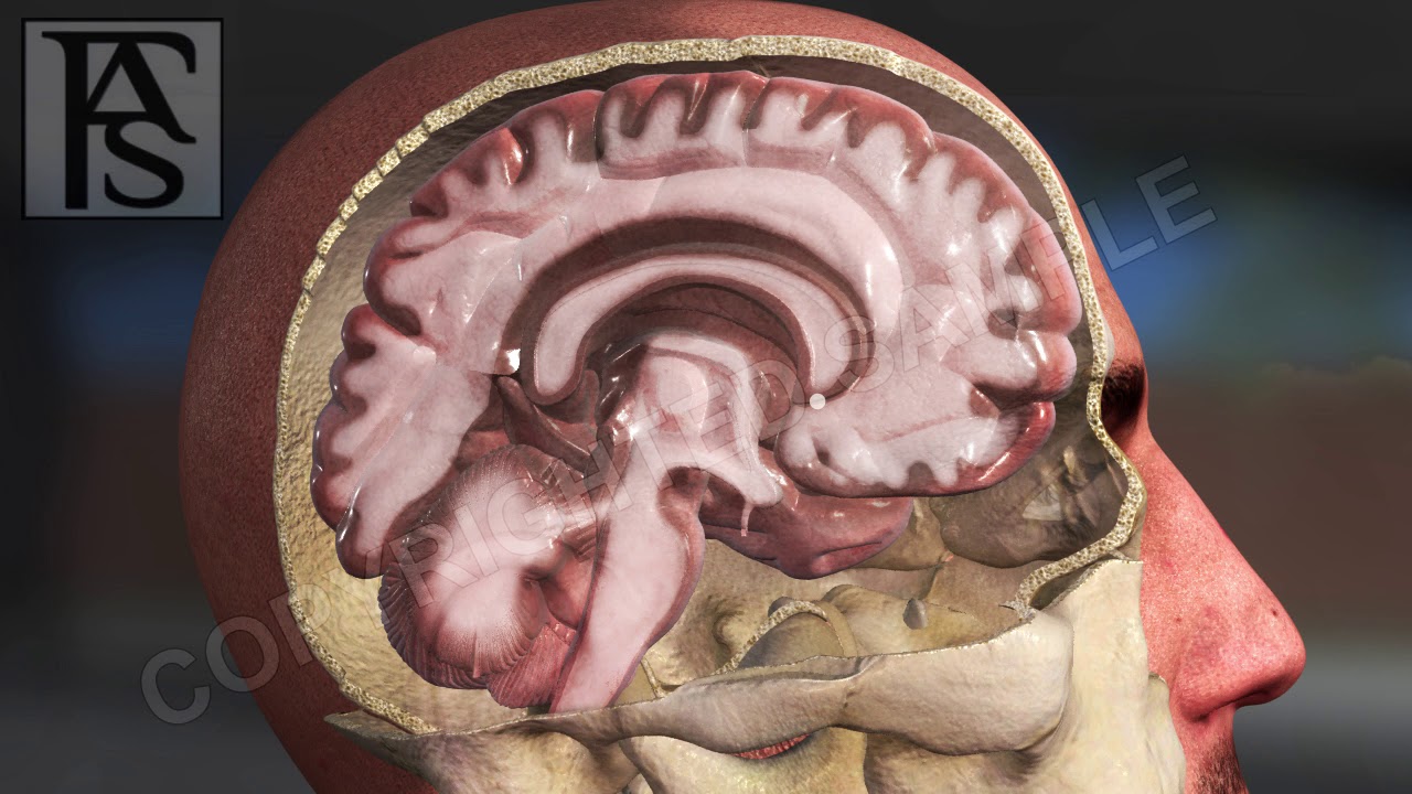 Traumatic Brain Injury Animation - YouTube