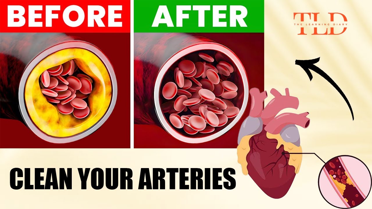 What to Eat to Clean Out Your Arteries | 7 Best FOODS | Artery Detox ...