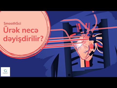 ÜRƏK TRANSPLANTASİYASI ƏMƏLİYYATI