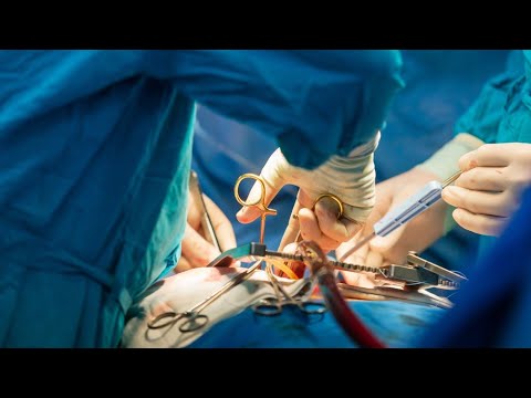 Cone Repair Surgery for Ebstein’s Anomaly in an Adult Patient - YouTube