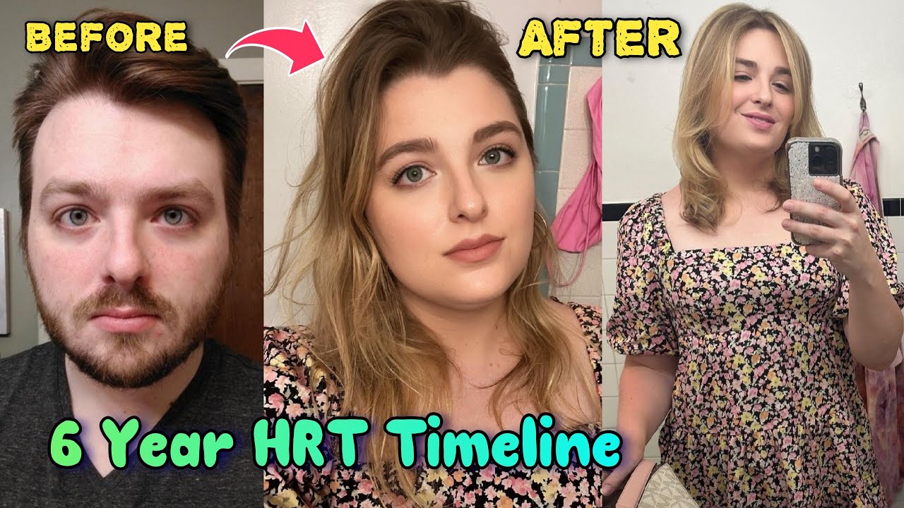 Male to Female 6 Years Transition Journey | Boy to Girl Transition ...