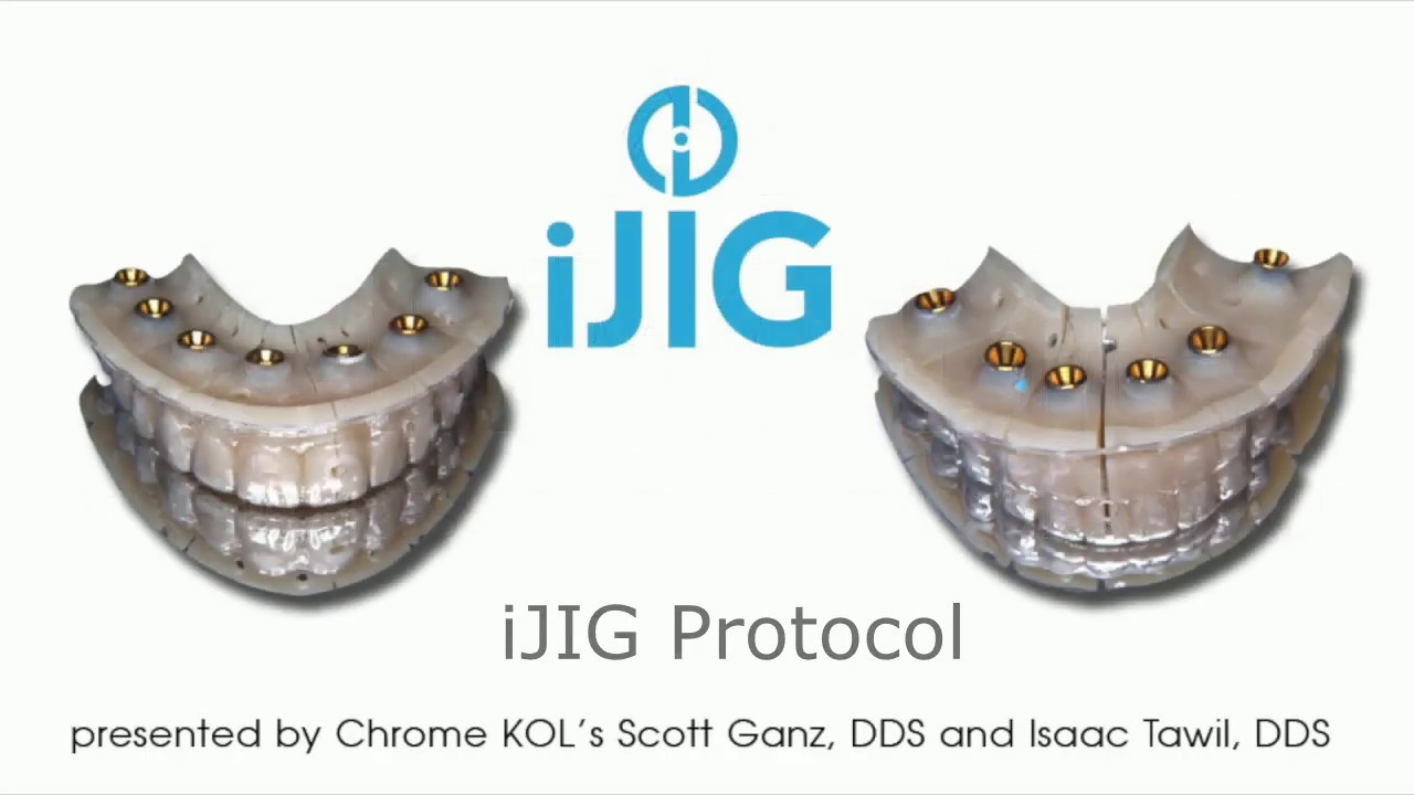 CHROME All-on-X - iJig - YouTube