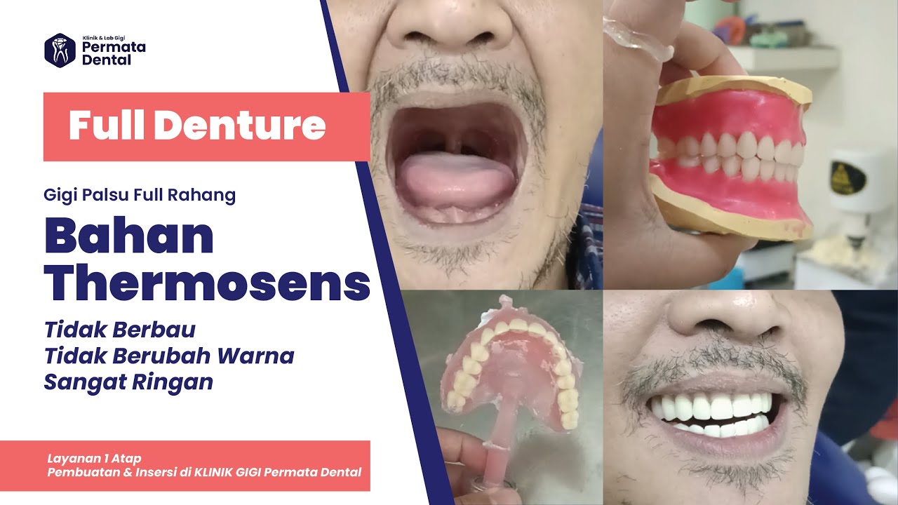 Pembuatan & Insersi Gigi Palsu Thermosens di Klinik Gigi Permata Dental ...