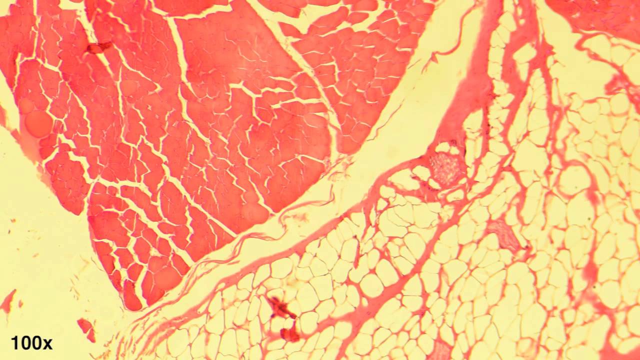 Steak Histology - YouTube