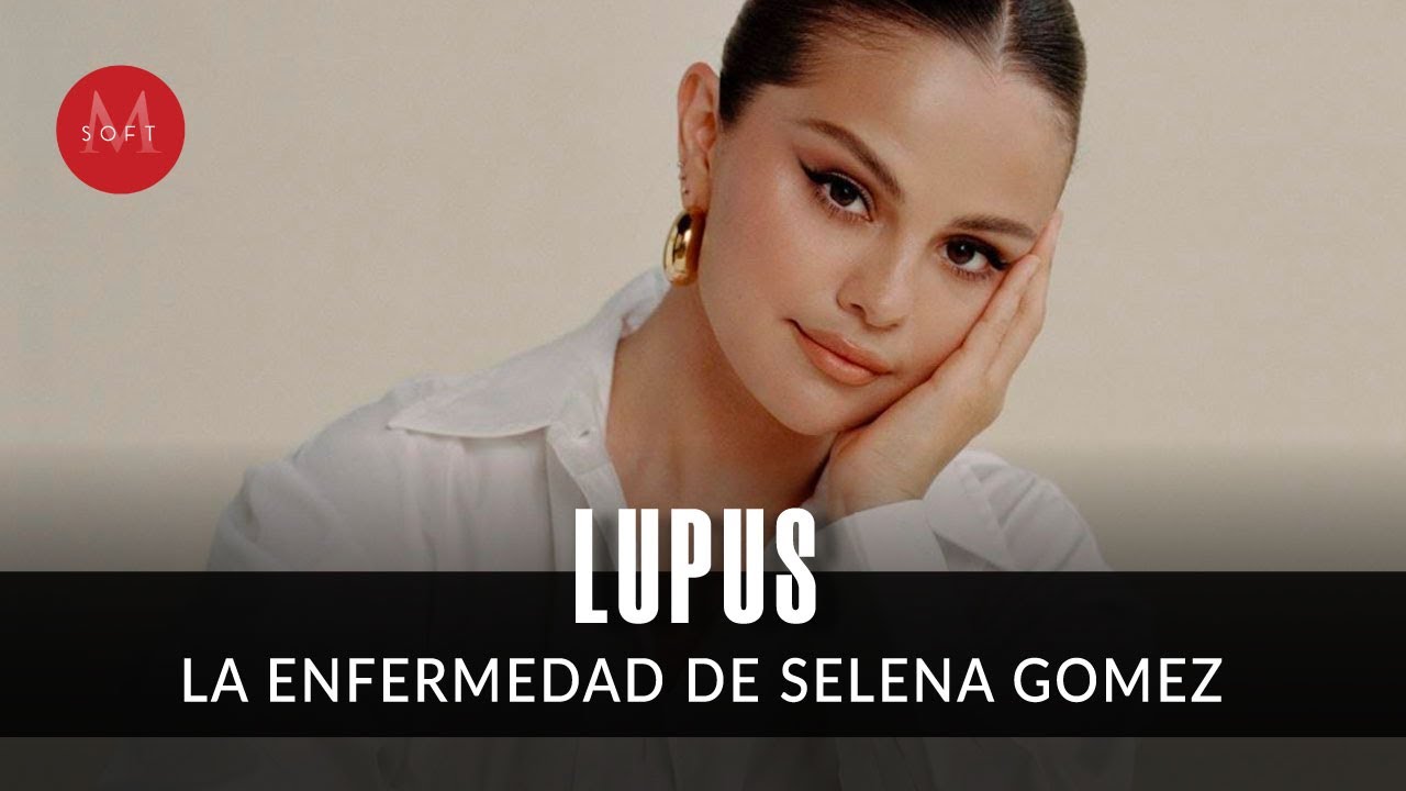 Lupus: Qué es y cómo identificar la enfermedad que tiene Selena Gomez ...