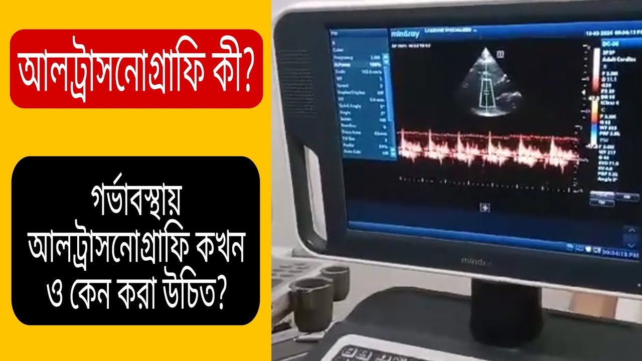 How to work Ultrasound Machine. আল্টাসাউন্ড মেশিন। - YouTube