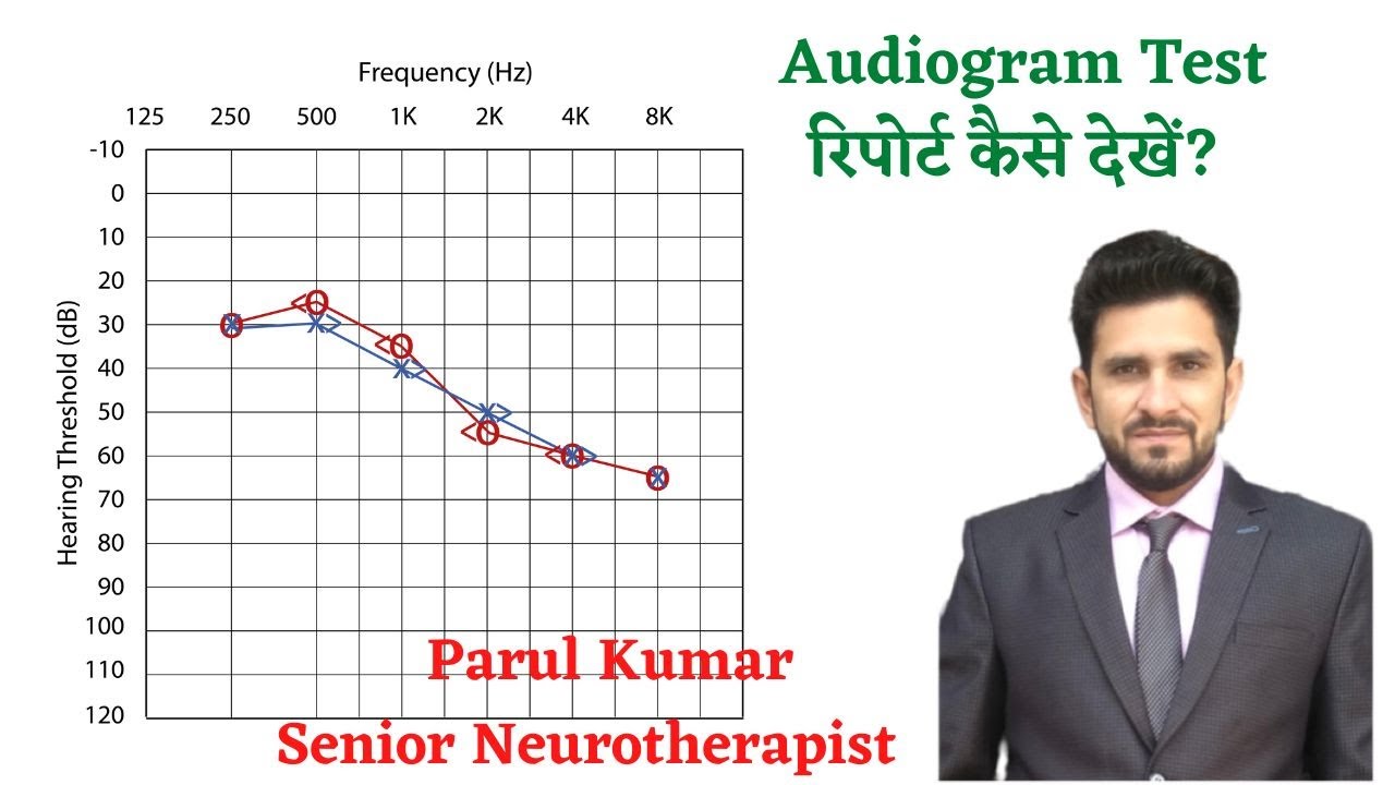 How to read Audiogram Report कान की रिपोर्ट कैसे देखें - YouTube