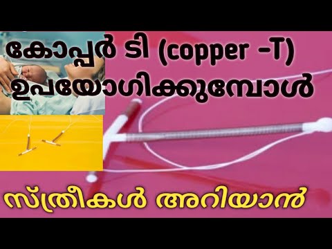 CuT Insertion|Procedure| Copper T insertion|Intrauterine devices|All ...