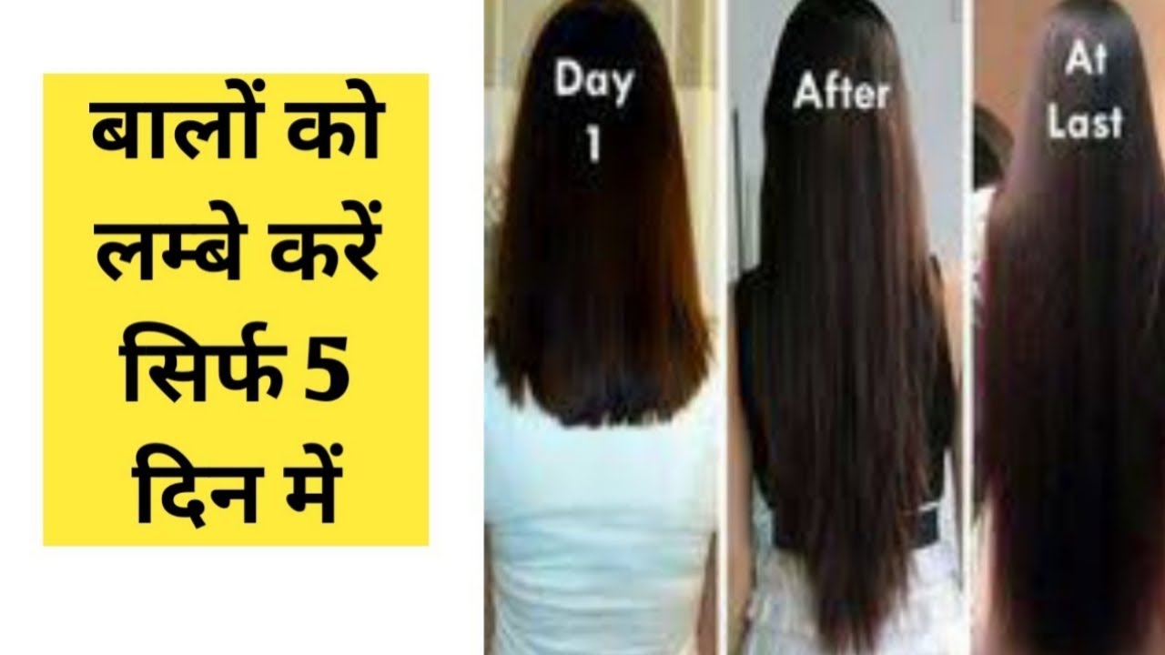 hair growth in 5 days ll fast hair growth remedy - YouTube