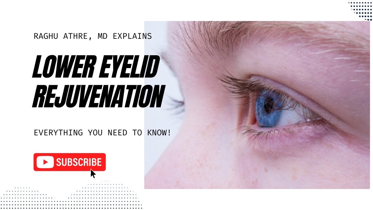 Tone Up Your Eyes With These Lower Eyelid Rejuvenation Tips - YouTube