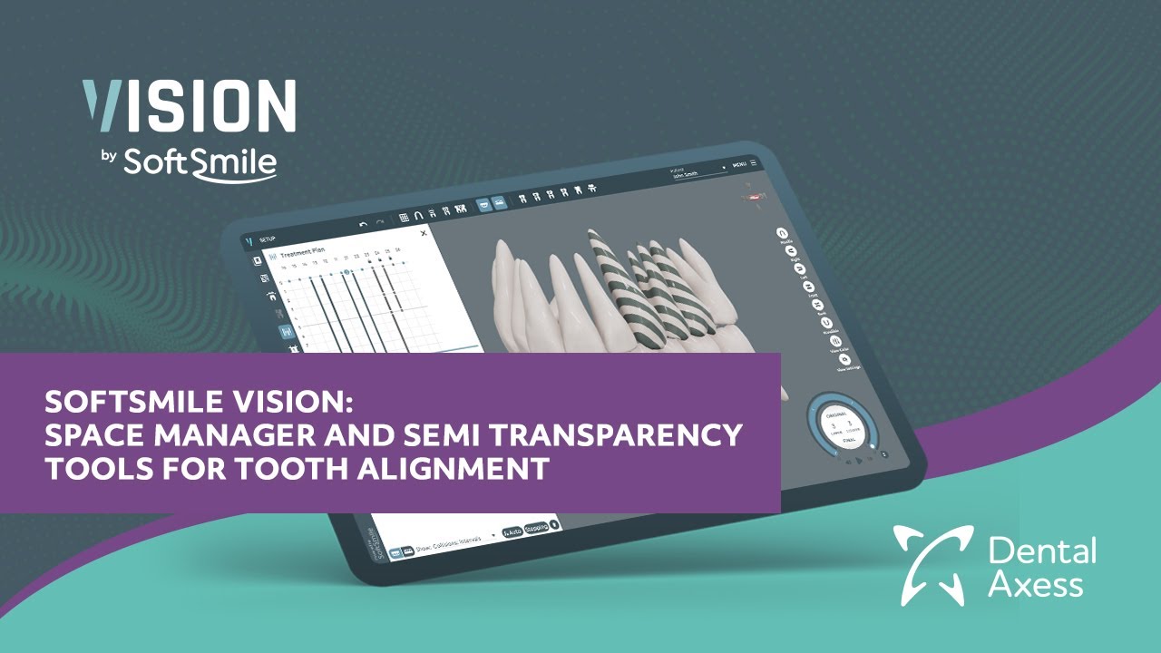SoftSmile VISION: Space manager and semi transparency tools for tooth ...