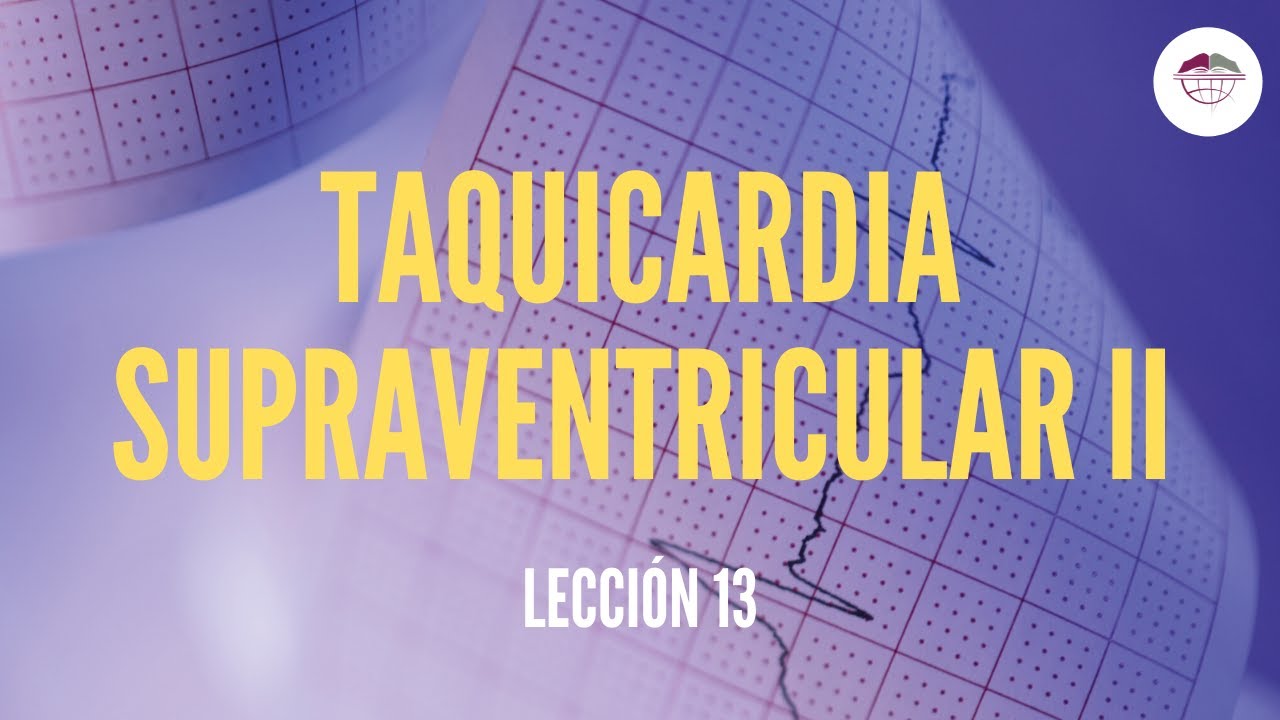 13. TAQUICARDIA SUPRAVENTRICULAR II: ACTITUD TERAPÉUTICA ...