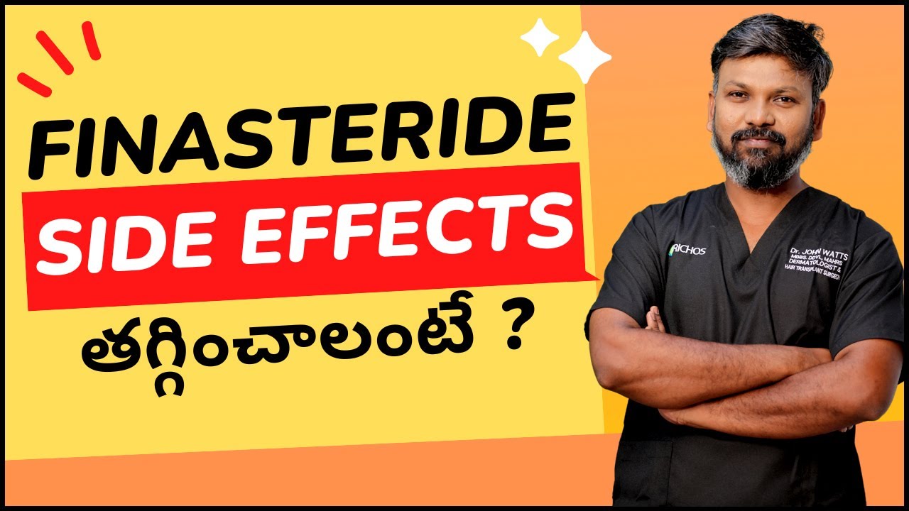 #AskDrJohnWatts | FINASTERIDE SIDE EFFECTS తగ్గించాలంటే ? | Hair ...