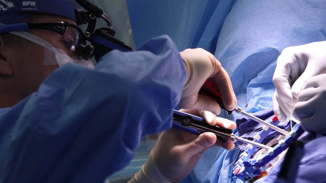 'Miami Method' is less invasive option for patients with heart issues ...