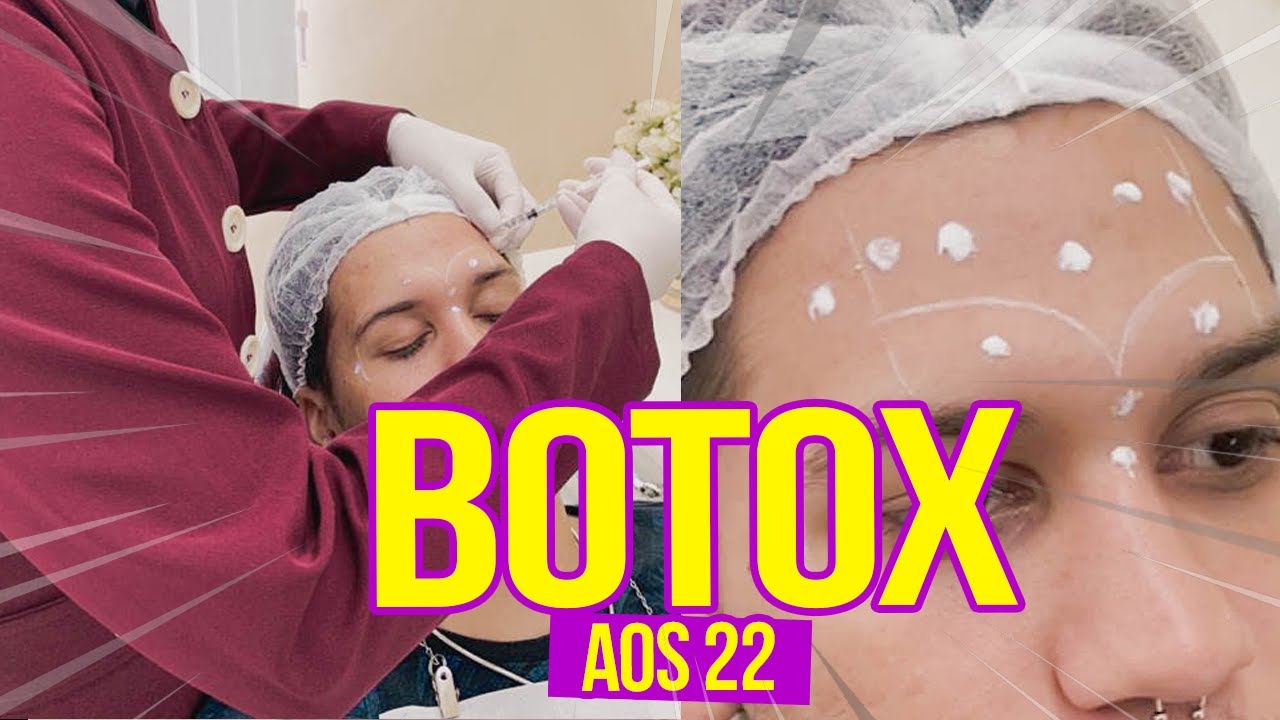 VLOG: COLOQUEI BOTOX 😱 | LUIZ HENRIQUE - YouTube