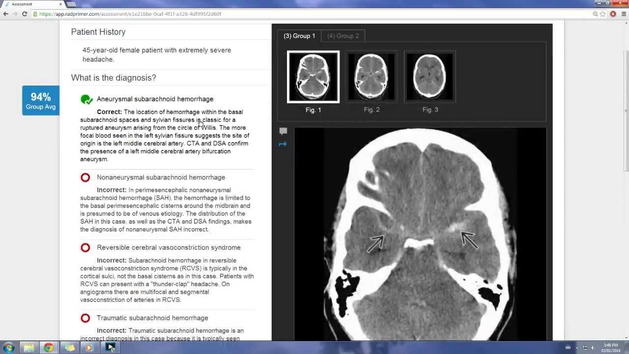 RADPrimer Review - Radiology Exam Prep for the ABR or Royal College ...