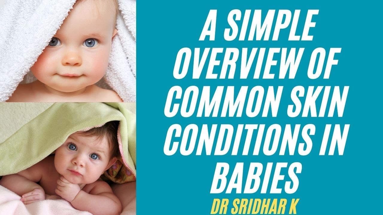 Skin rash ll Simple overview of common skin conditions in babies - YouTube
