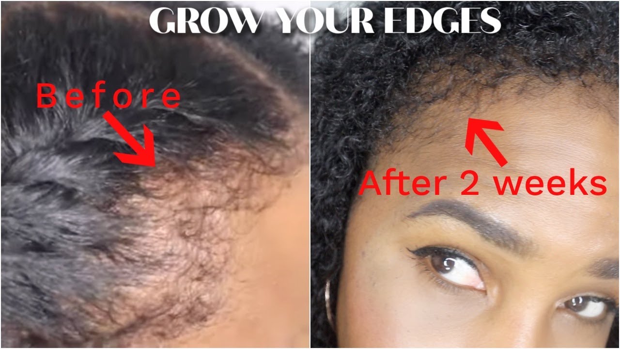 DIY: HOW TO GROW YOUR EDGES | HAIR GROWTH CHALLENGE | MEL'S WORLD - YouTube