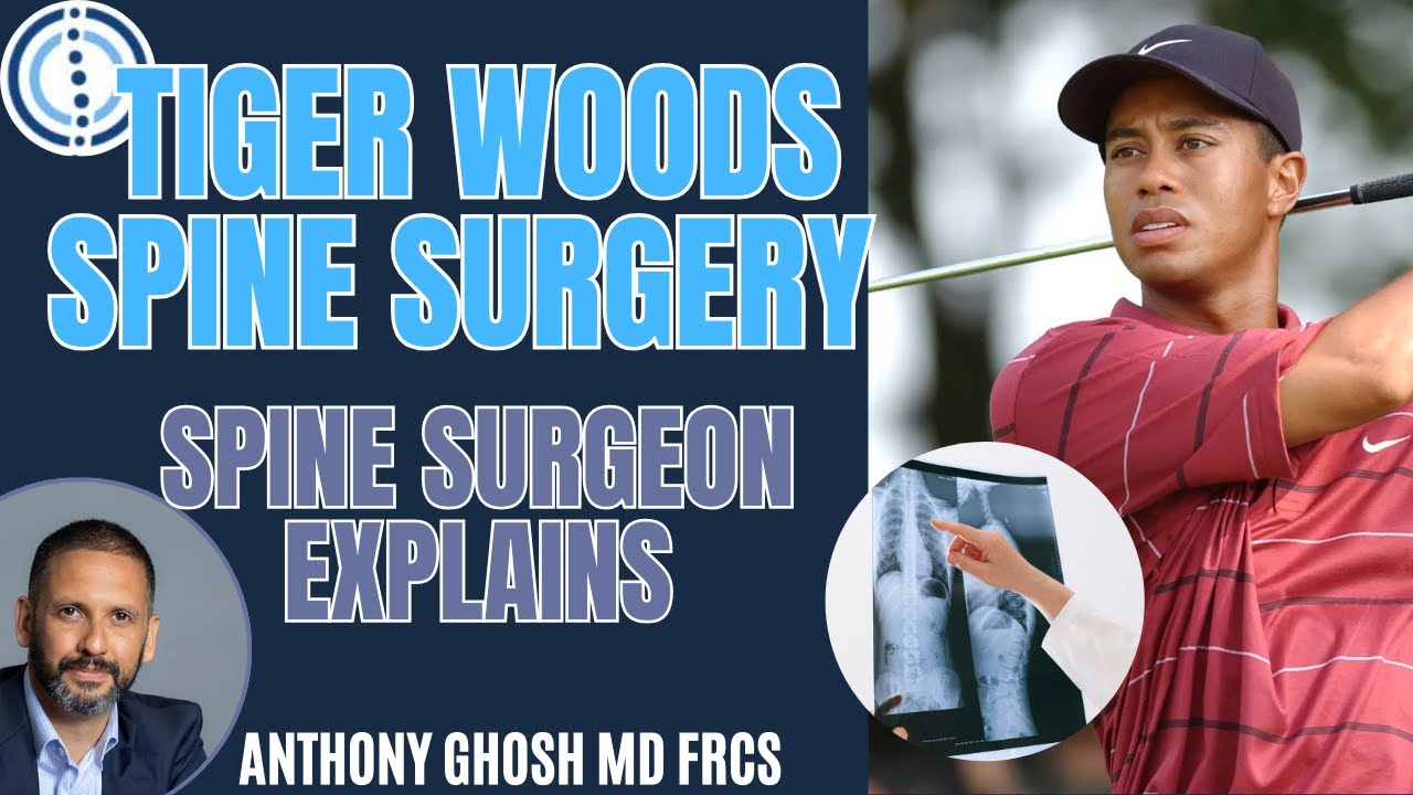 Tiger Woods Spine Surgery - Spine surgeon explains - YouTube
