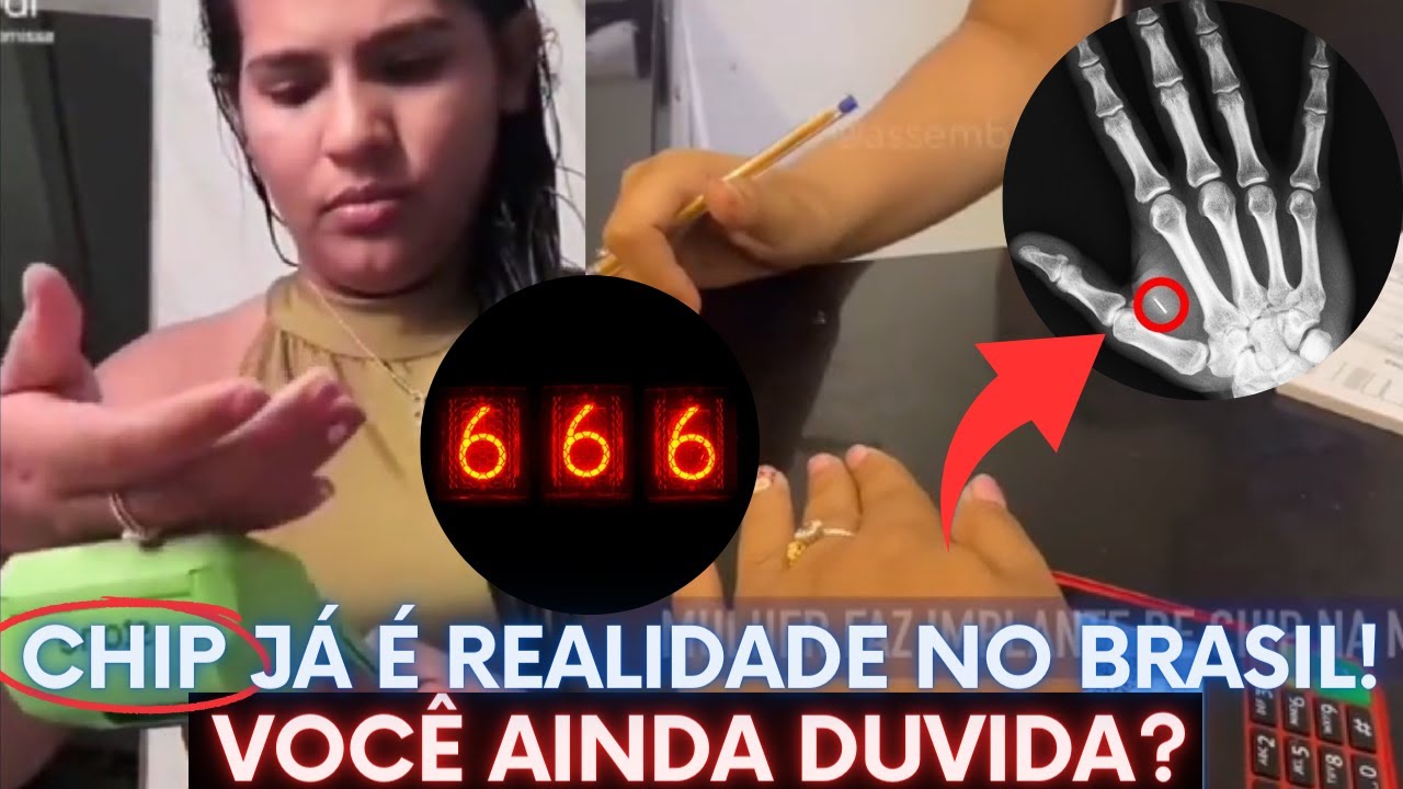 🌱🌳💪CHIP na mão já é realidade no Brasil! Você ainda duvida? Será a ...